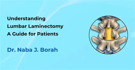Understanding Lumbar Laminectomy A Guide For Patients Dr Naba J Borah