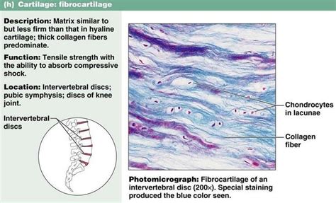 Fibrocartilage Connective Tissue Labeled