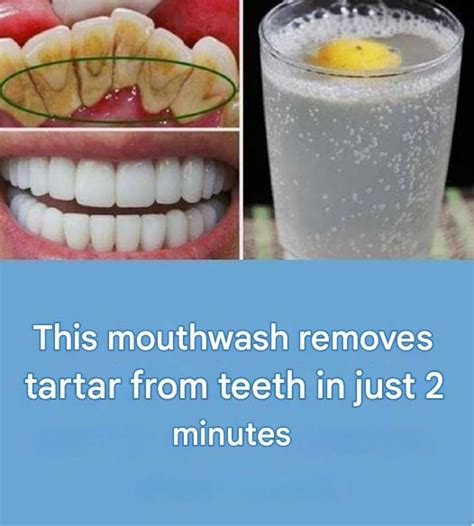 How To Have White Teeth 15 Tips For A Pretty Smile Best Recipes