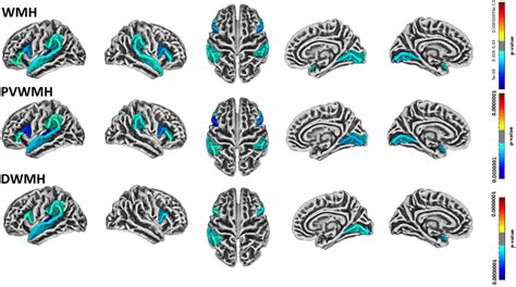 Multiple Linear Regression Analysis Results Define The Association Download Scientific Diagram