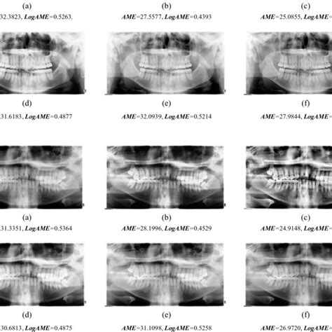 Pdf Tufts Dental Database A Multimodal Panoramic X Ray Dataset For