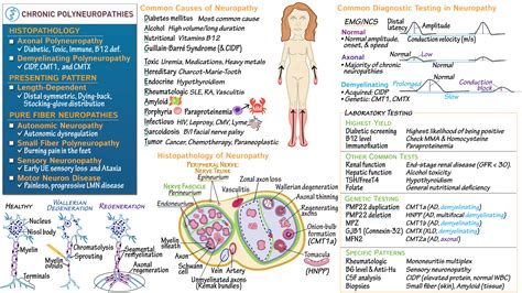 Pathology Polyneuropathies Charcot Marie Tooth Diagnostic Testing Draw It To Know It