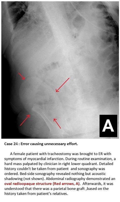 Error Causing Unnecessary Effort Download Scientific Diagram