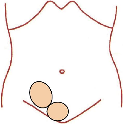 Diagram To Enable Patient To Identify Areas Where Pain Was Felt The Download Scientific