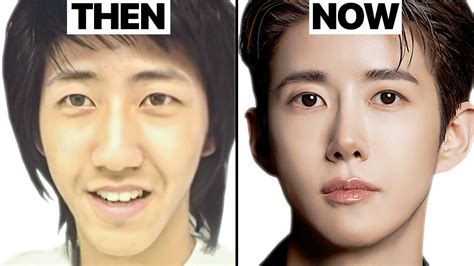 Korea Plastic Surgery Before And After Photos