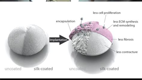 The Dangers Of Silicone Breast Implants Youtube