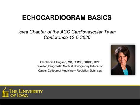 Echocardiogram Basics Iowa Acc Cv Team 12 5 2020 1 Pdf