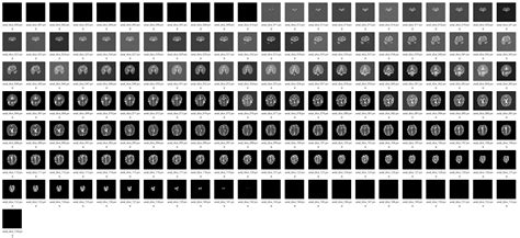 python code to export nifti volume slices produces brightness