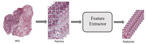 patches are encoded into a descriptive feature representation using a
