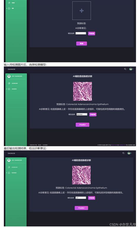 【传知代码】双深度学习模型实现结直肠癌检测(论文复现)selfencoder Nnmodulelist Csdn博客 【传知代码】双深度学习模型实现结直肠癌检测(论文复现)selfencoder Nnmodulelist Csdn博客