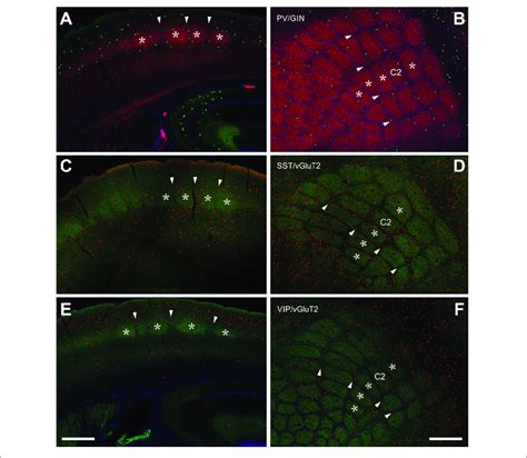 Localization Of PV SST And VIP Interneurons In The Barrel Download Scientific Diagram