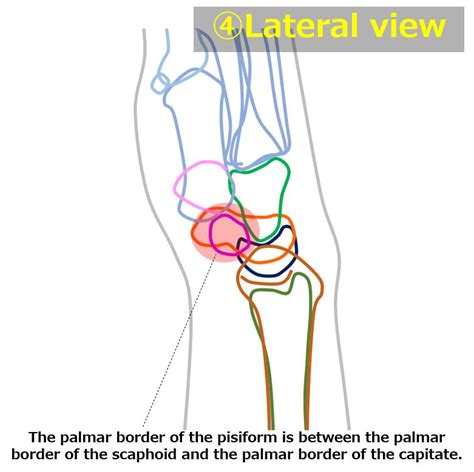 Scaphoid View｜tools For Radtech