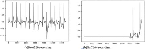 Figure 3 From A Resnet Bilstm Multi Lead Ecg Classification Method Embedded With Attention