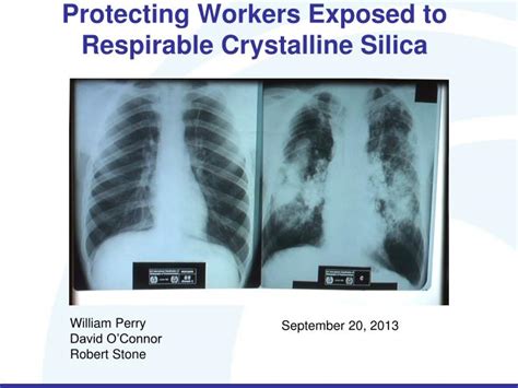 Ppt Protecting Workers Exposed To Respirable Crystalline Silica