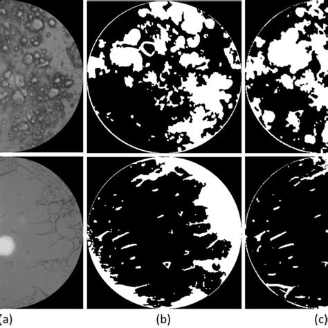 segmented results from model 1 first row shows positive pco and second