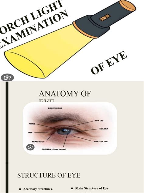 Torch Light Examination Full Complete Pdf