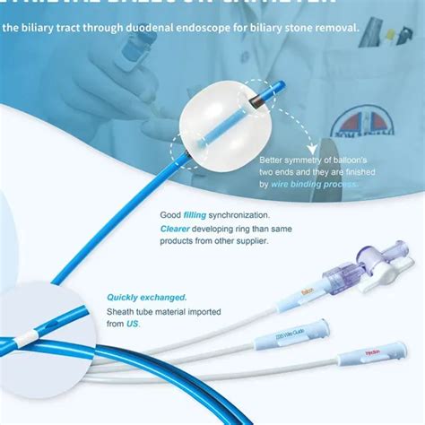 Ercp Endoscopy Accessories Single Use Stone Retrieval Balloon Catheter For Endoscopic Removal Of