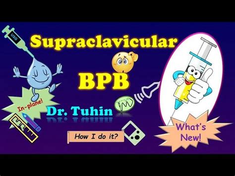 Tuhin M On Linkedin Supraclavicular Brachial Plexus Block In Plane