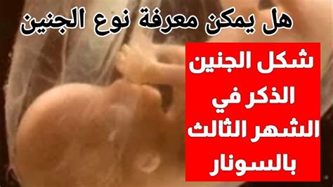 شكل الجنين في الشهر الثالث الذكرشكل الجنين الذكر في الشهر الثالث
