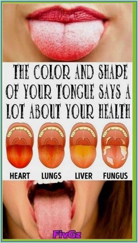 What Your Tongue Says About Your Health Wodaso Artofit
