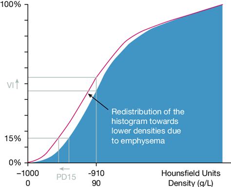 Cumulative Frequency Distribution Histogram Of Lung Density At The