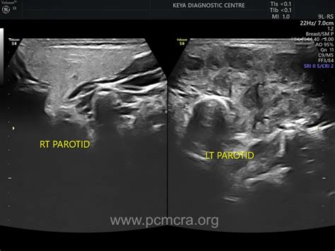Interesting Cases Pimpri Chinchwad Maval Chakan Radiology Association