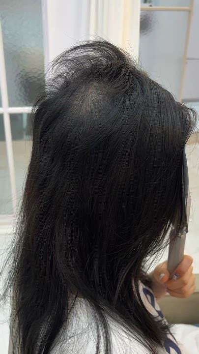 발모벽 고치고 미팅 성공 Hairextension 붙임머리 헤어증모술 머리뽑는금쪽이 Youtube