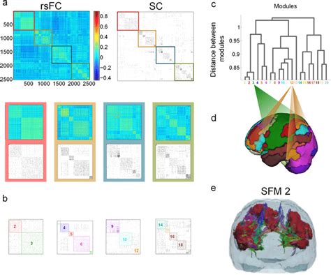 Strong Similarities Between Structural And Functional Brain Networks Download Scientific