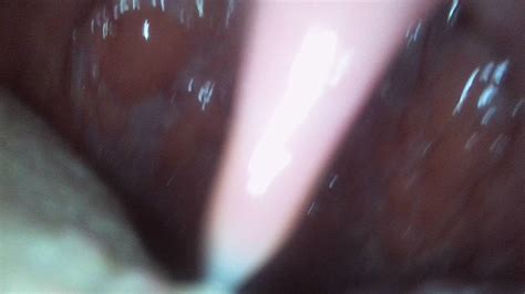 Mouth Tour Endoscope View