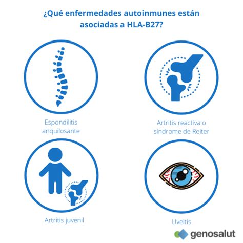 hla b27 identificación de subtipos asociados a autoinmunidad genosalut
