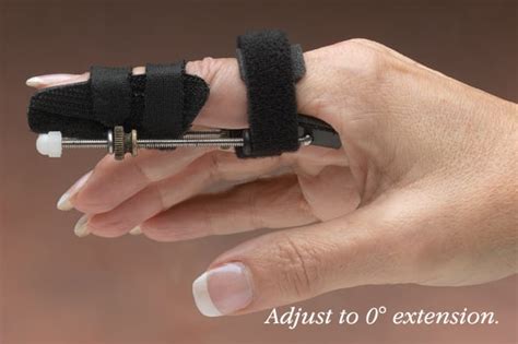 Static Progressive Pip Finger Extension Splint North Coast Medical