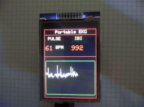 arduino portable ekg monitor artofit