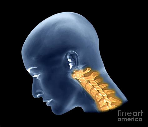 Normal Flexed Neck X Ray By Science Photo Library