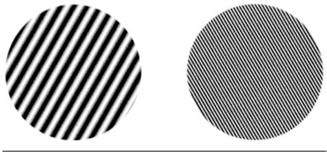 Figure 1 From Visual And Language Processing Deficits In Compensated