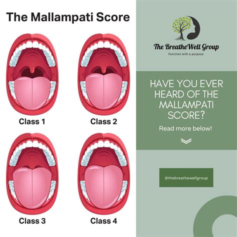 The Breathewell 🔎 What Is The Mallampati Score 🩺 The Mallampati