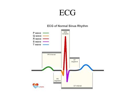 Optimal Ecg Data Compression For An E Health Transmission System