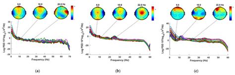 Diagnostics Special Issue Machine Learning Approaches For