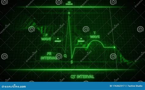 p and t wave from electrocardiogram wave or ecg or ekg stock video