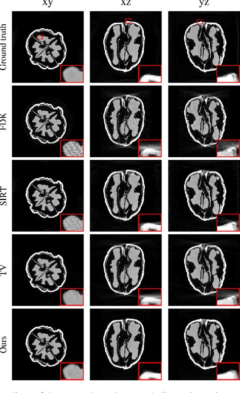 Learned Cone Beam Ct Reconstruction Using Neural Ordinary Differential