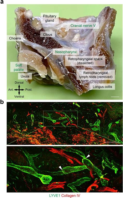 Location Of The Nasopharyngeal Lymphatic Plexus In The Mucosa Of The Download Scientific