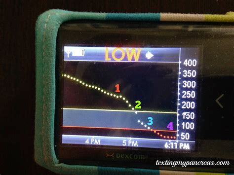 Texting My Pancreas Anatomy Of A Dexcom Graph