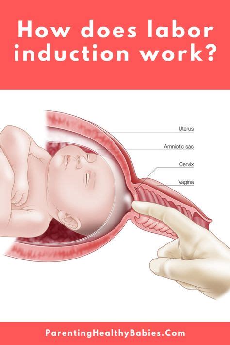 How Does Pregnancy Induction Work