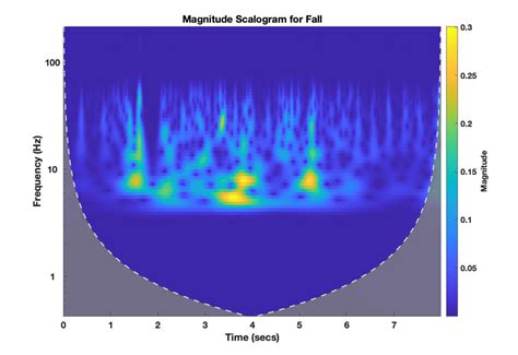 Scalograms With Different Classes Of Ecg Signal In Them Download Scientific Diagram