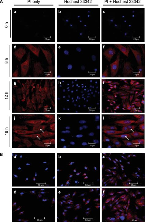 Figure 1 From Encapsulation Of Plasmid Dna In Calcium Phosphate Nanoparticles Stem Cell Uptake