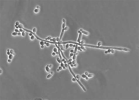 yeast sex life gets wild especially in hard times live science