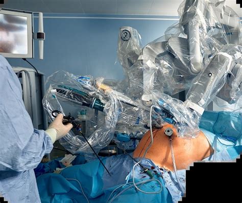 Gastric Bypass Surgery In San Antonio Advanced And Cost Effective Solution