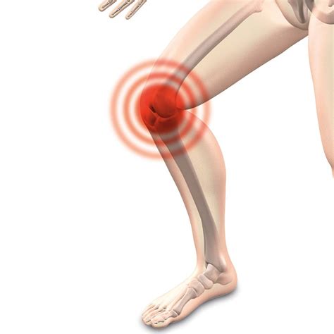 What Is Mri Arthrogram 🤔💡 An Mri Medifee Healthcare