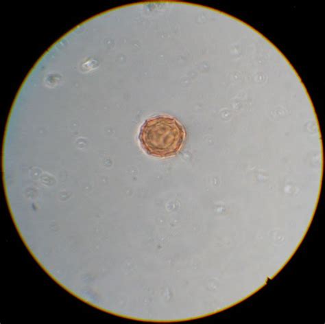 217 Questions With Answers In Morphology Science Topic