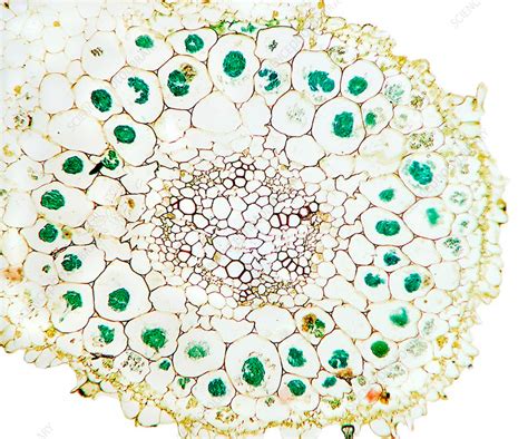 Orchid Mycorrhiza Light Micrograph Stock Image C019 8186 Science Photo Library Wine And