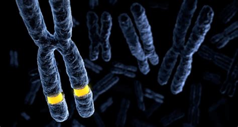 Drug Candidate Fails To Improve Symptoms Of Fragile X Syndrome